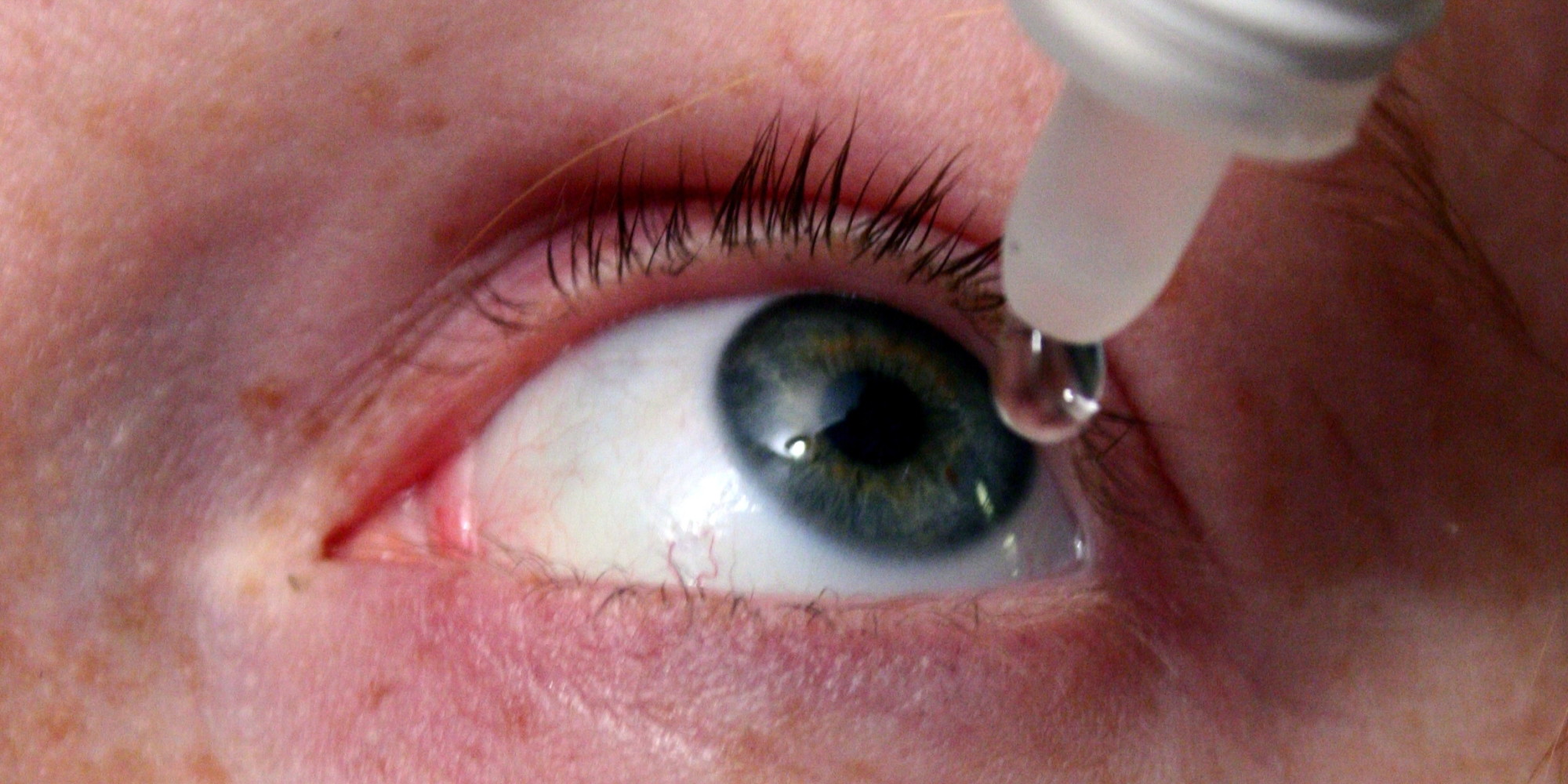 Eye Drops Could Treat Age Related Macular Degeneration HuffPost Eye Drops Could Treat Age Related Macular Degeneration HuffPost