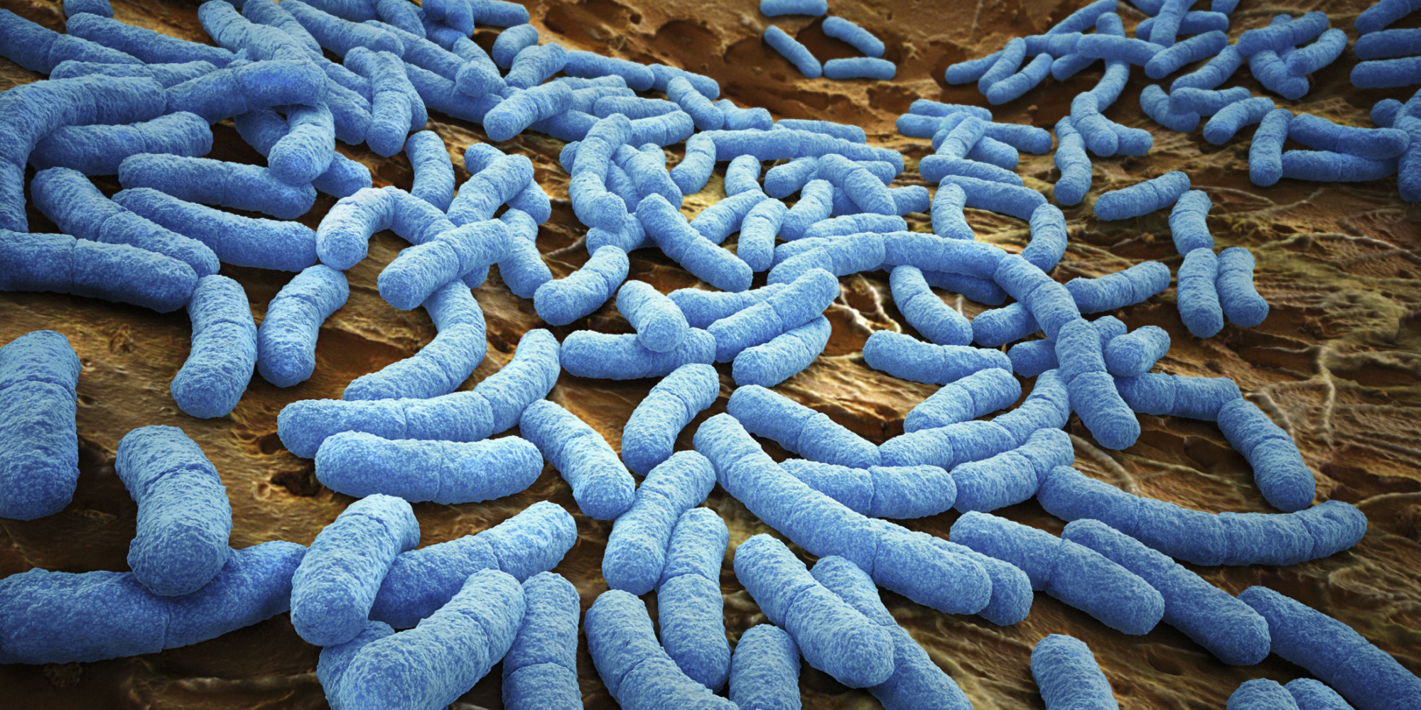23 000 Pounds Of Beef Trimmings Recalled Over Possible E Coli
