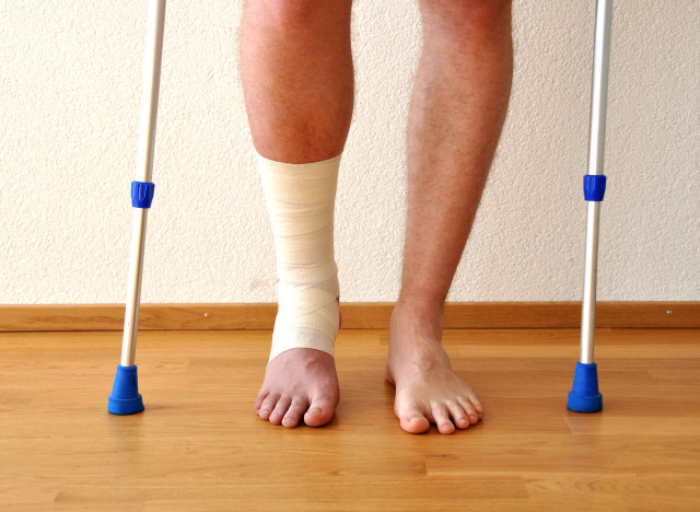 Comment guérir d'une fracture | Denis Fortier Comment guérir d'une fracture | Denis Fortier