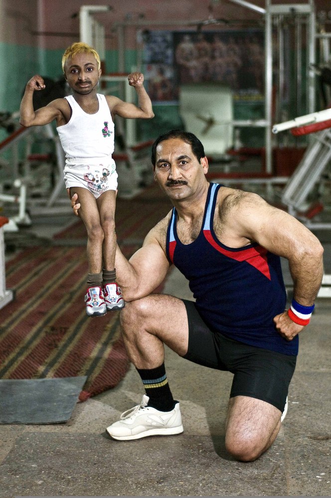 Aditya 'Romeo' Dev Dead: World's Smallest Bodybuilder Dies In India ...