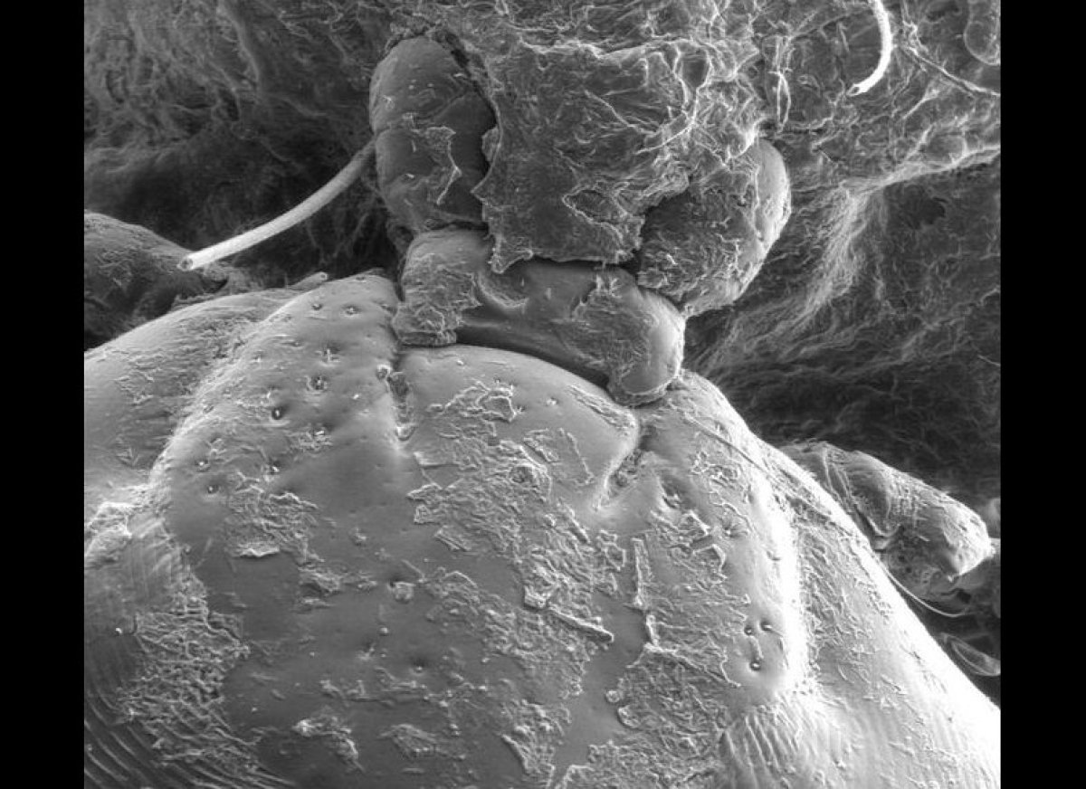 Electron Microscope Photos Show Spider Skin, Coffee, Dandelions, Tomato ...