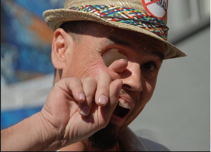 TIL A man lost an eye and half his face to cancer, and used it to start ...