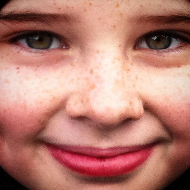 31 Powerful Photos That Prove Freckles Are Gorgeous | HuffPost