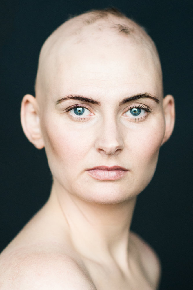 7 Stunning Portraits Of Women With Alopecia Redefine Femininity | HuffPost