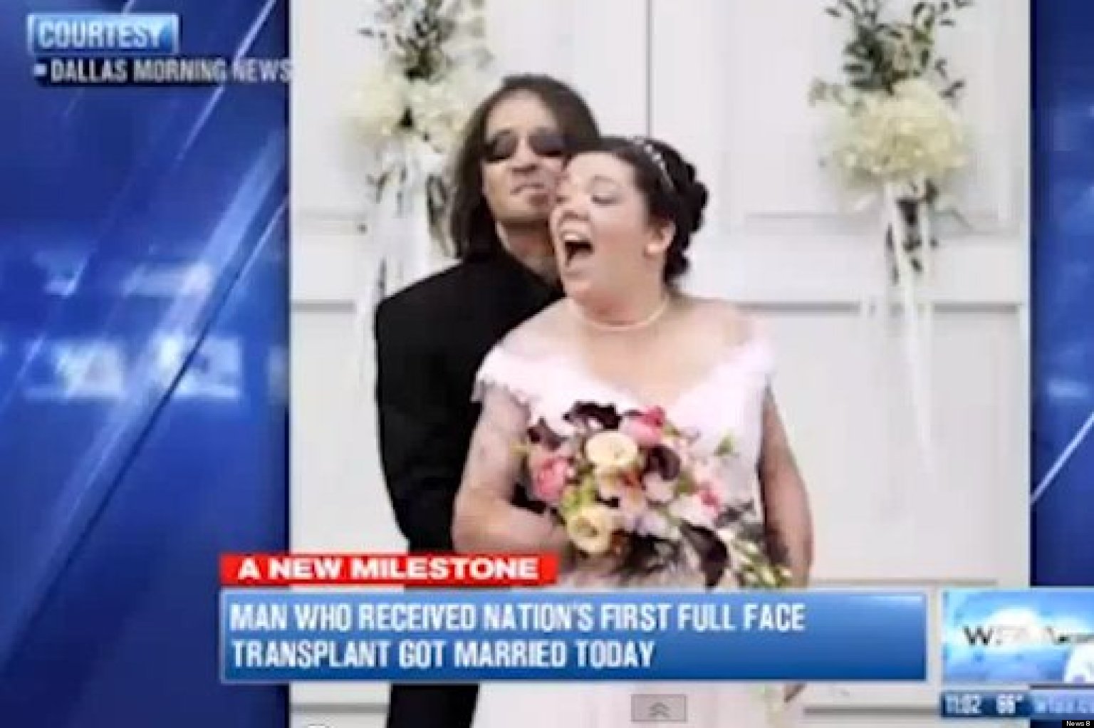 Dallas Wiens, Nation's First Full Face Transplant Recipient, Marries ...