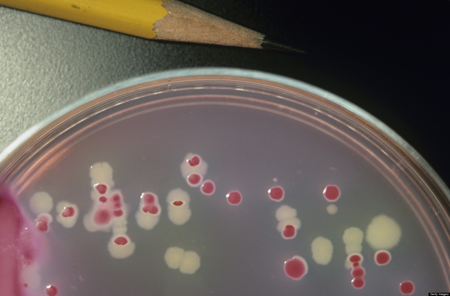 The 9 Germiest Places In Your Kitchen | HuffPost