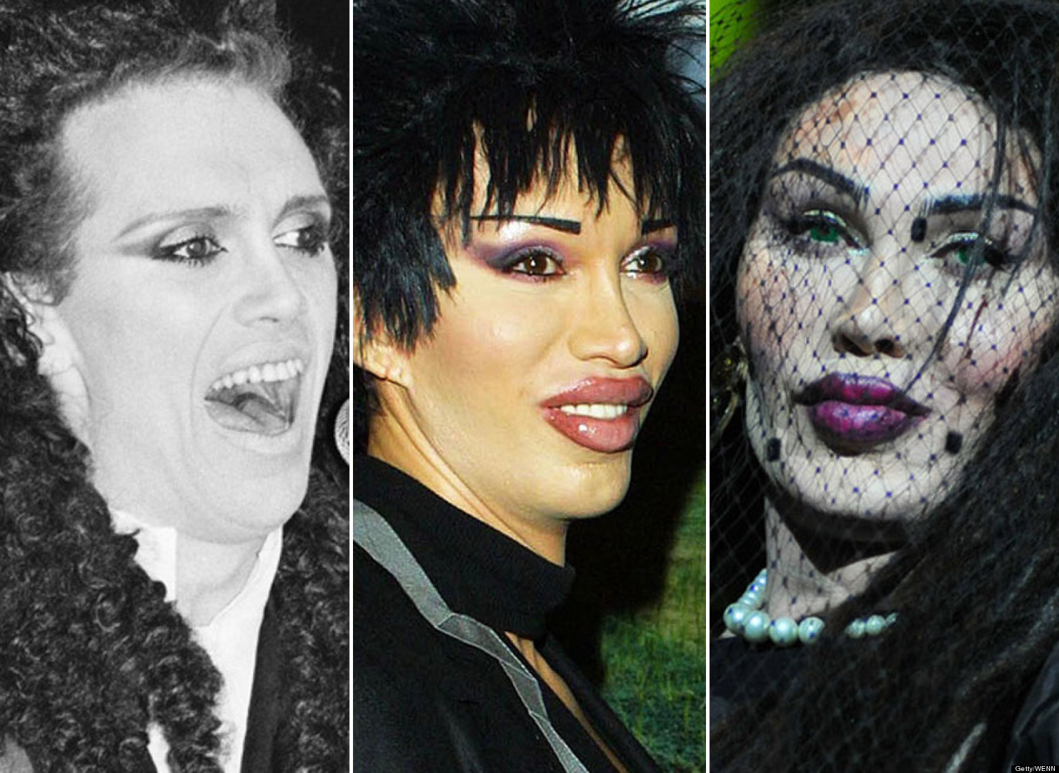Pete Burns Surgery: The Changing Face Of The Dead Or Alive Singer ...