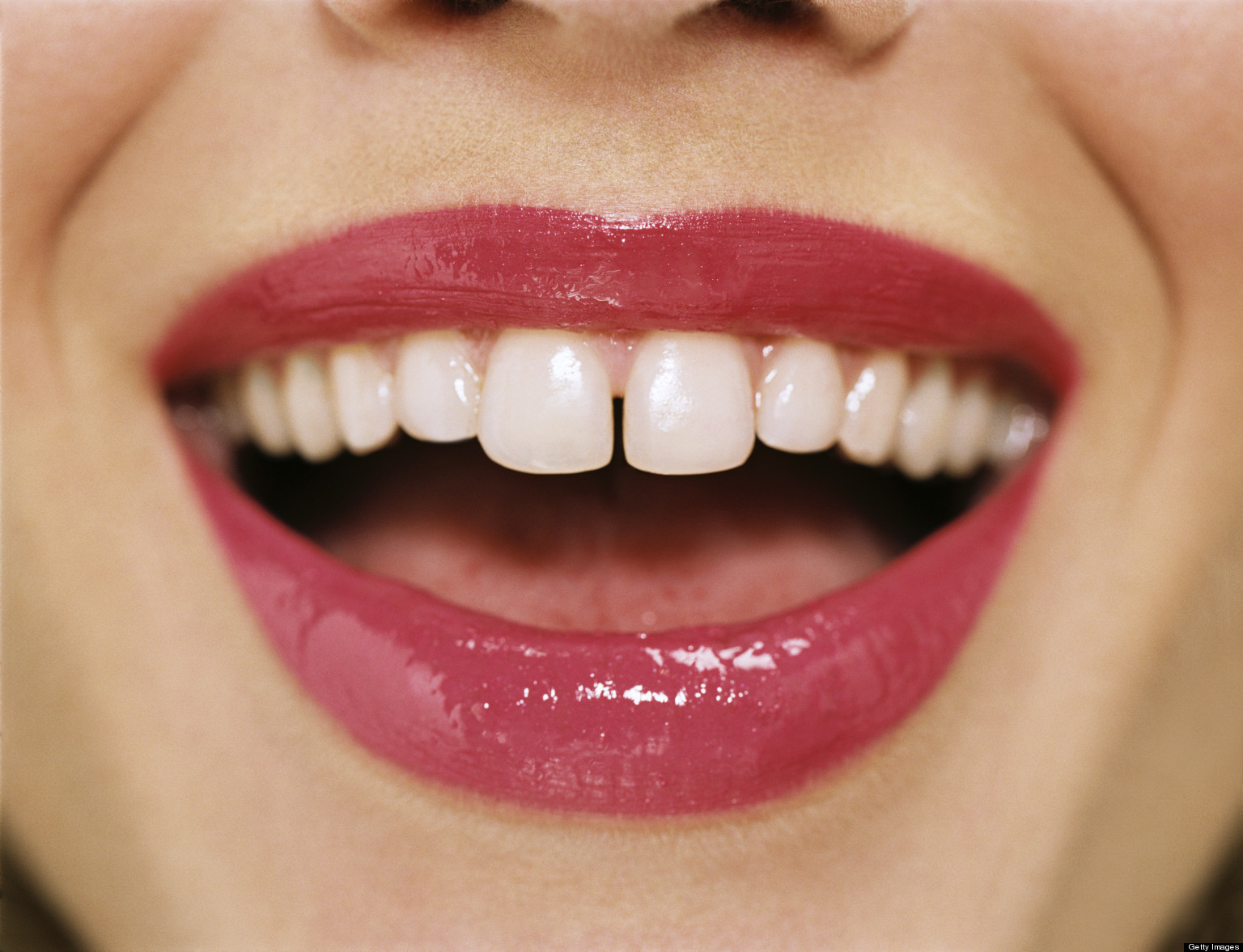 Small Mouth Smile