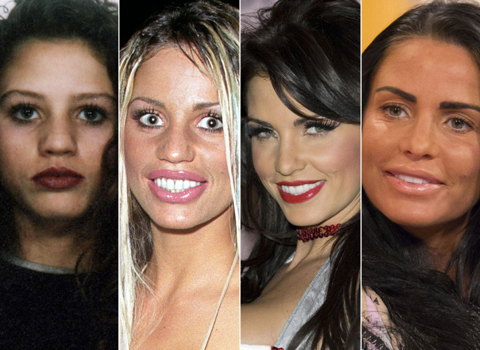 Katie Price Plastic Surgery Before And After Pinteres - vrogue.co