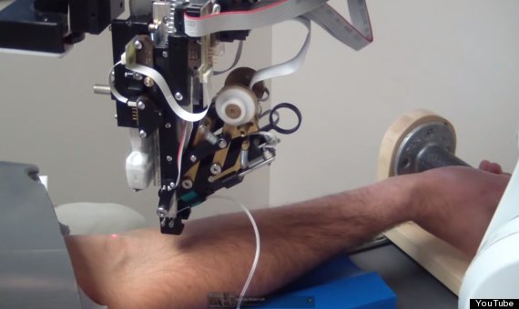 Veebot Robot Will Draw Your Blood Better Than A Human (If You're Brave ...