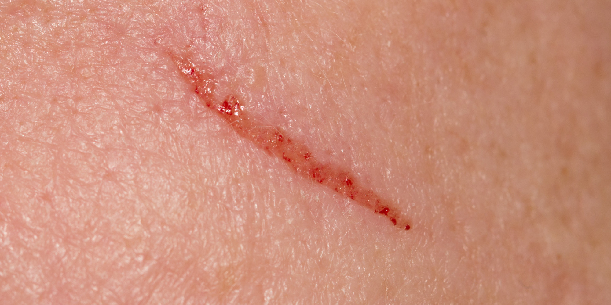 11 Things You Need to Stop Apologising for, Right This Second | HuffPost UK