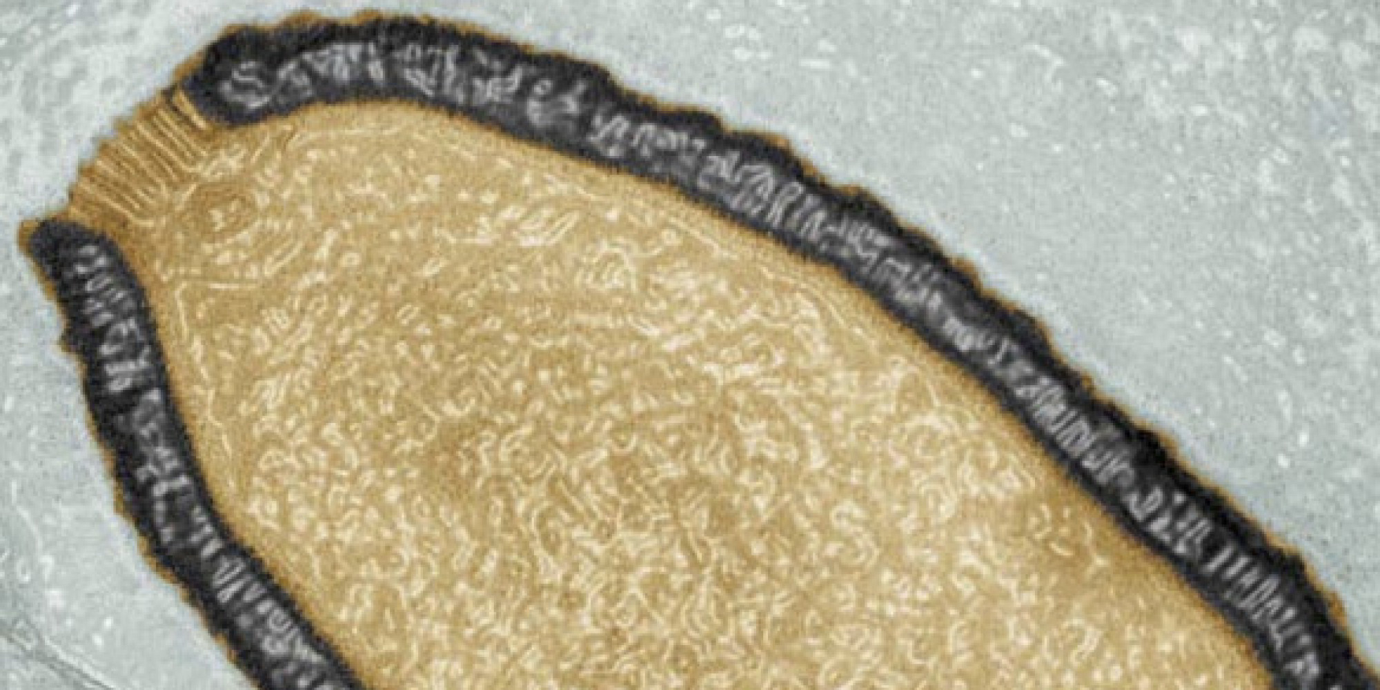 Ancient Virus 'Resurrected' From 30,000-Year-Old Ice In Siberia | HuffPost