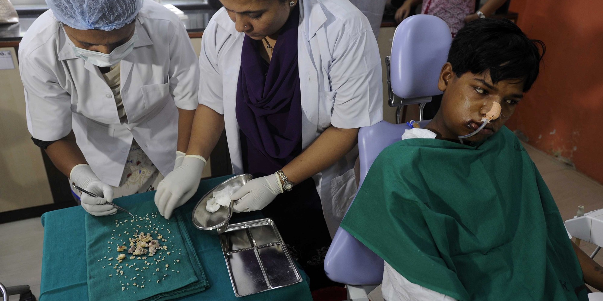 Doctors Remove 232 Teeth From Teen's Mouth In India | HuffPost