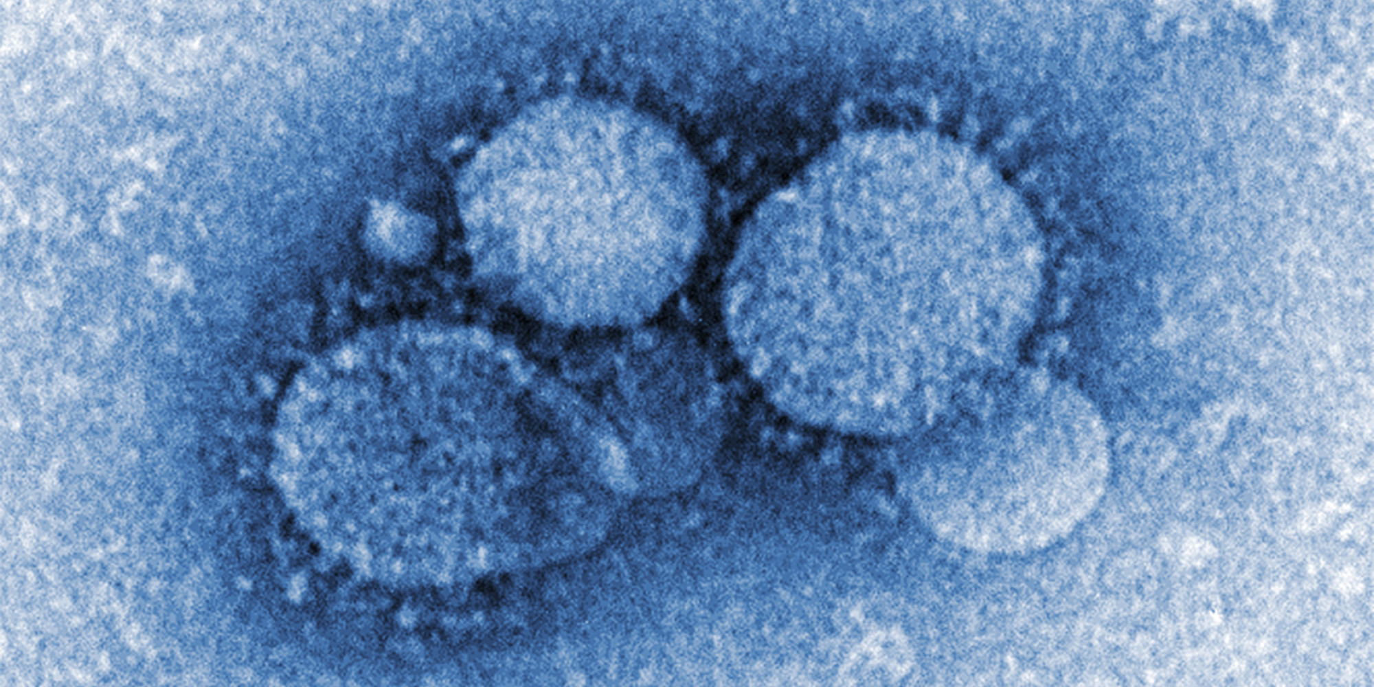 Scientists Find Mild Cases Of MERS Among Patients' Families | HuffPost