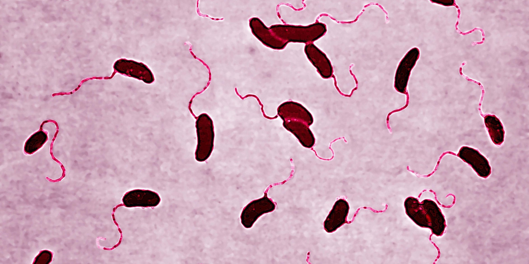LOOK: The Toll Of Cholera, in 1832 And In 2010