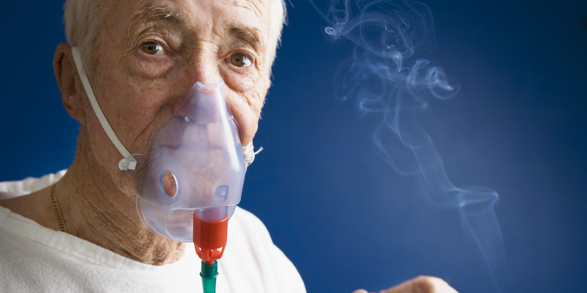 Smoking Causes More Than Half Of Bladder Cancer Cases, And Patients Who ...