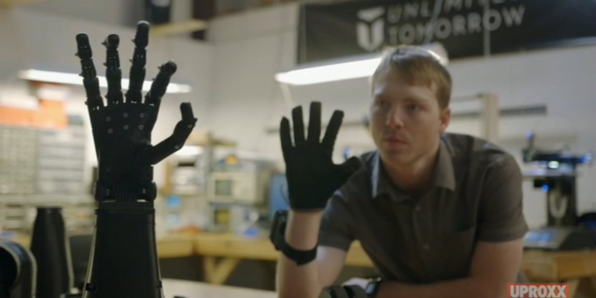 At 14, He Vowed To Invent An Affordable Prosthetic Limb. 5 Years Later ...