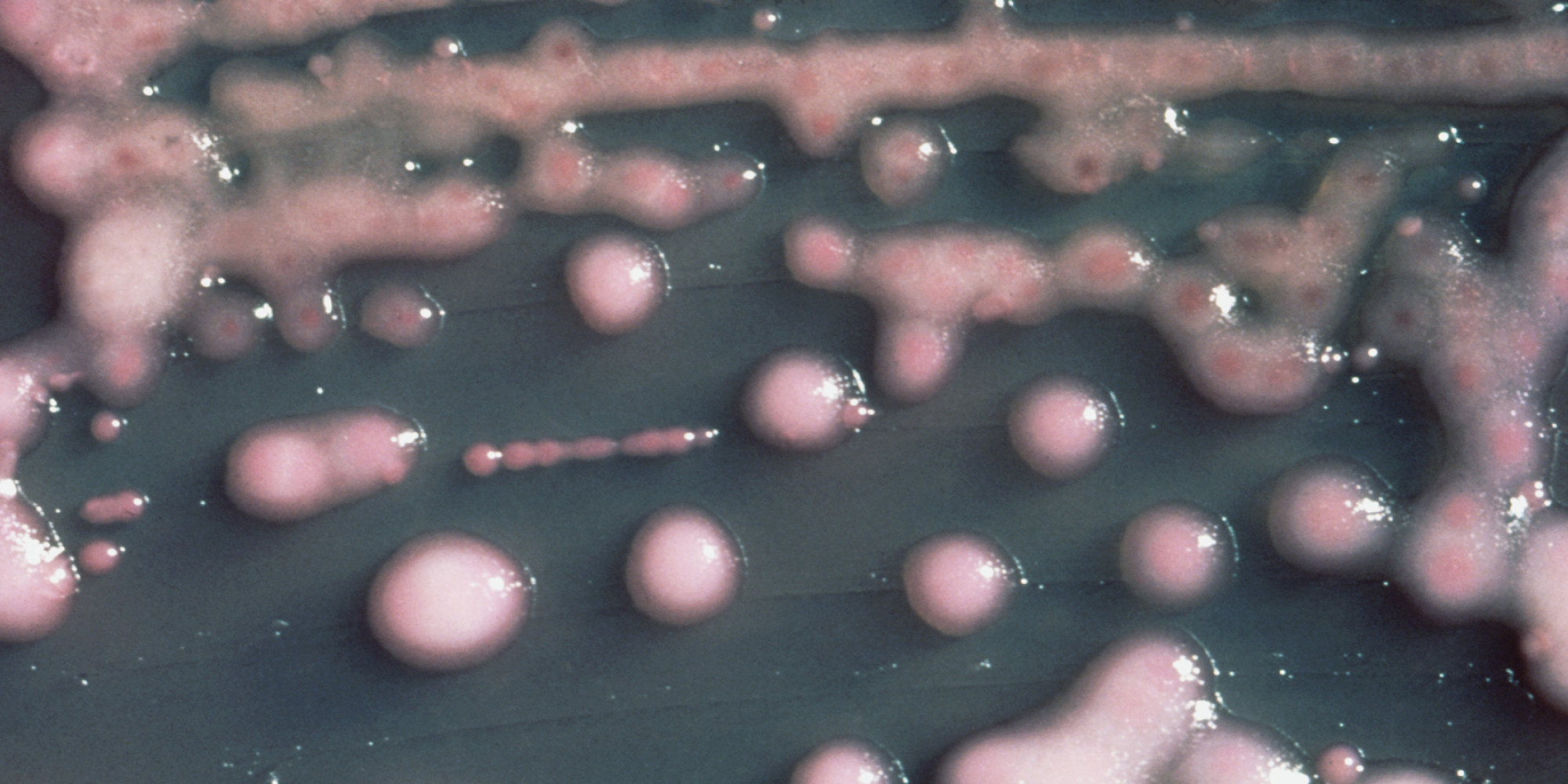 What Are The 'Superbugs' Known As Carbapenem-Resistant ...