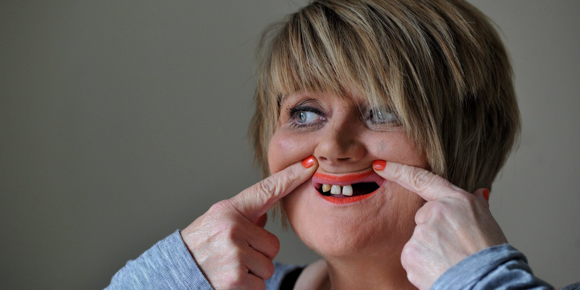 Woman Wakes Up From Hysterectomy Operation With Teeth Missing, Claims ...