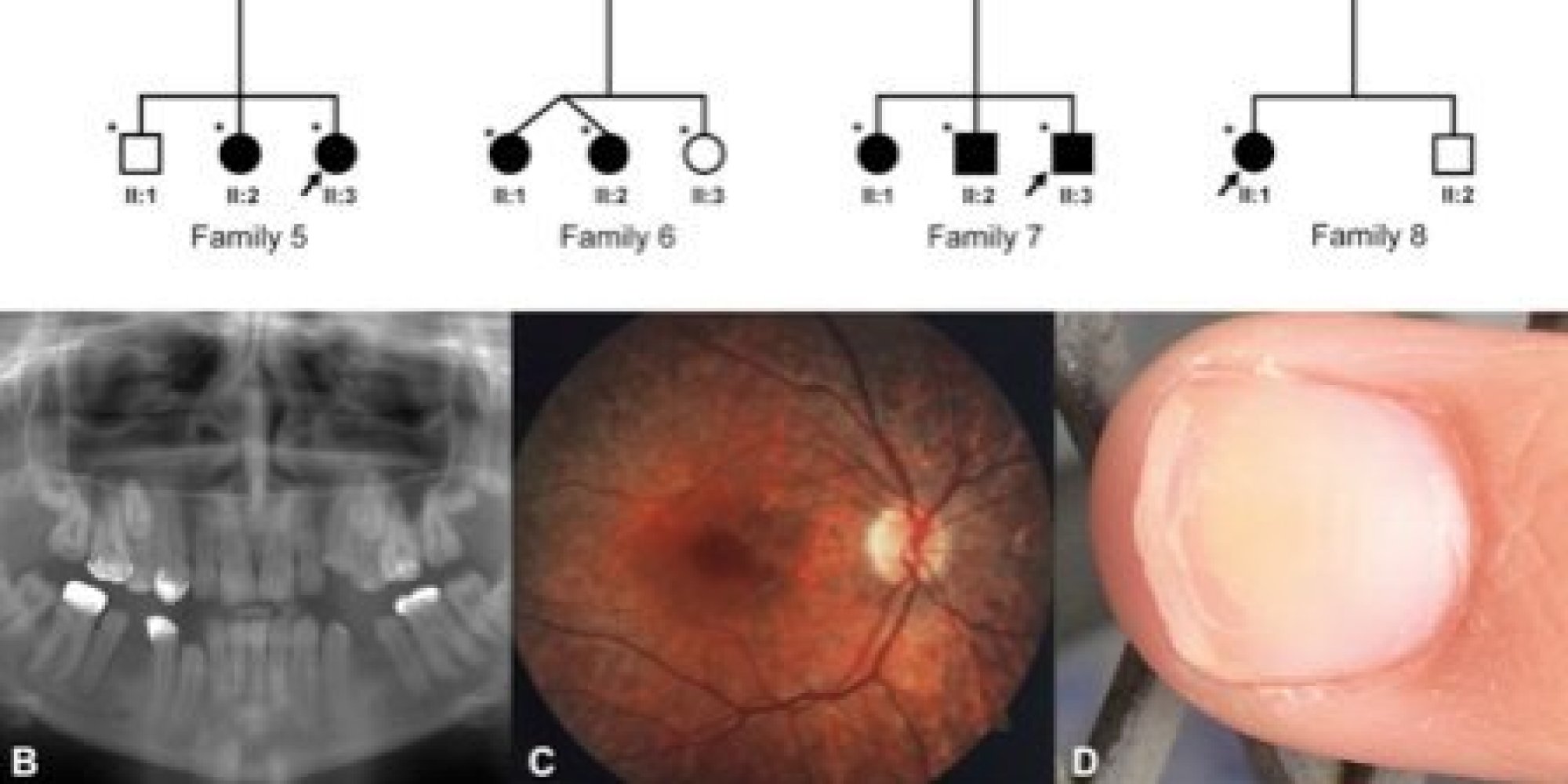Des chercheurs marocains contribuent à la découverte des causes d'une ...