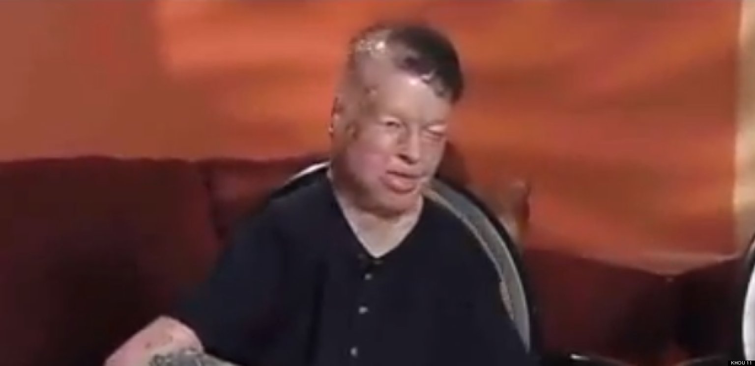 Robert Middleton Burned